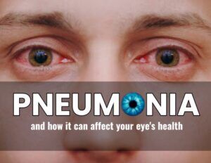 Pneumonia and How It Can Affect Your Eye’s Health